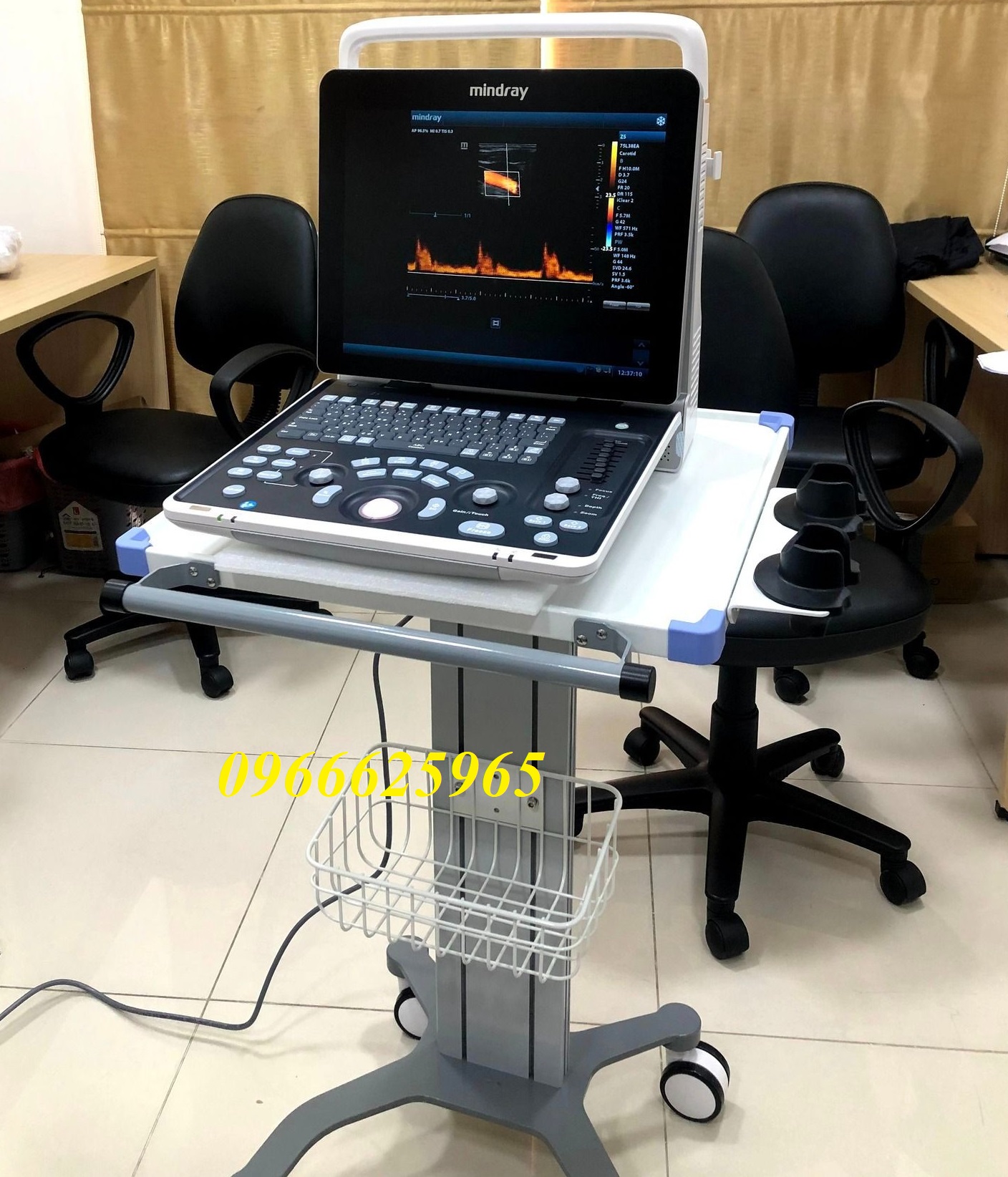 Máy siêu âm xách tay Mindray Z5 liệu có đáng mua không?