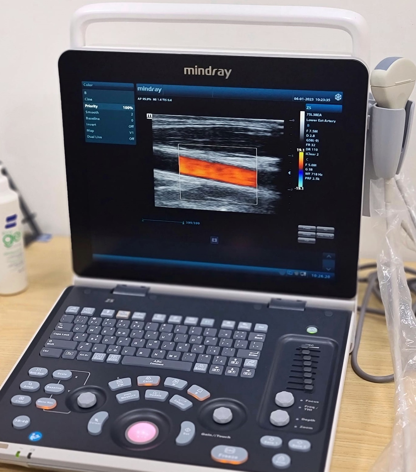 Đánh giá chất lượng máy siêu âm Mindray Z5 có nên mua không?